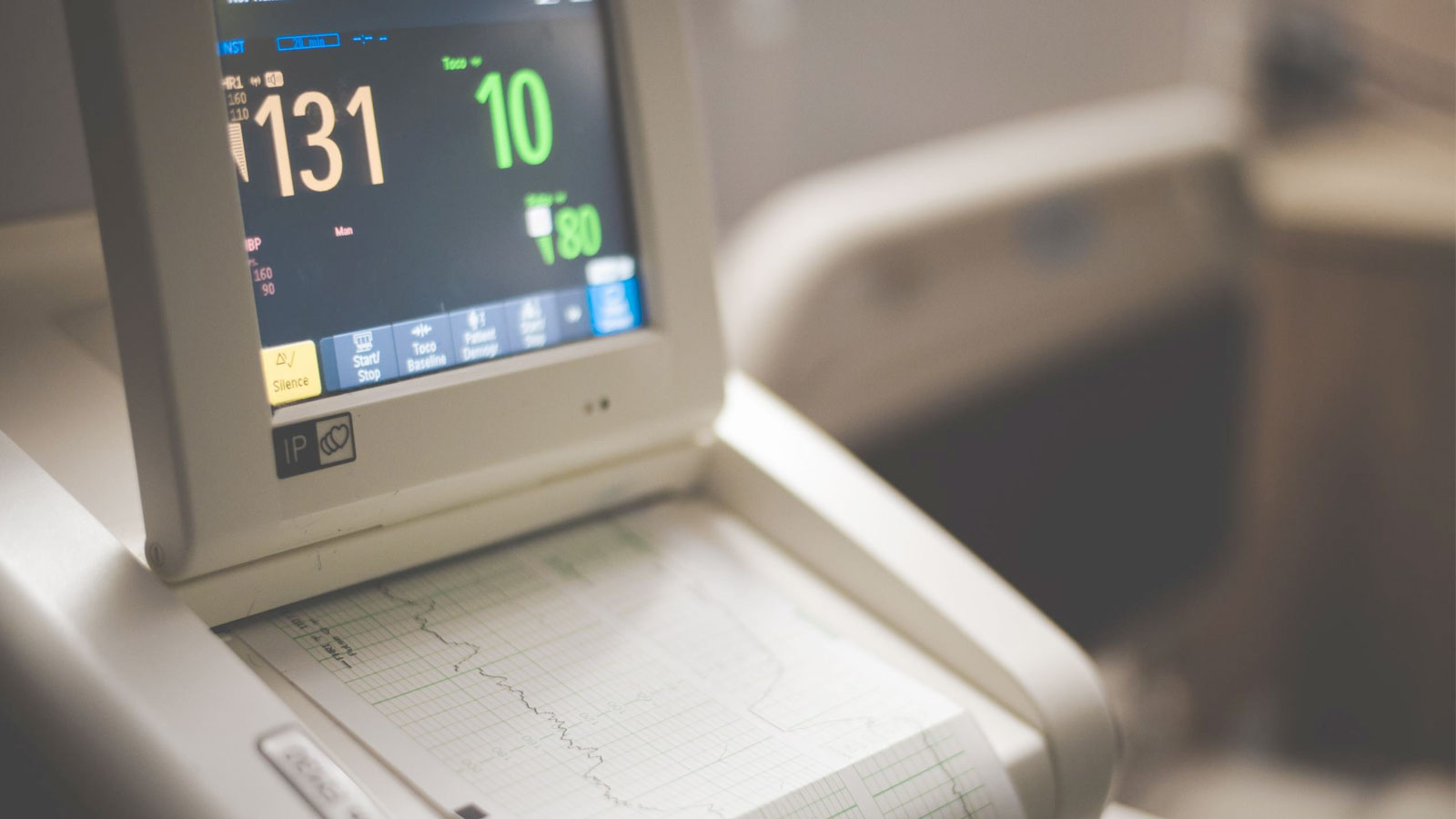 Carotid Artery Screening: Purpose, Preparation, and Procedure - Mint ...